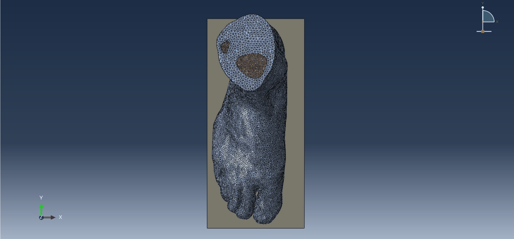 Digital Orthopaedics, Personalized healthcare - Dassault Systèmes