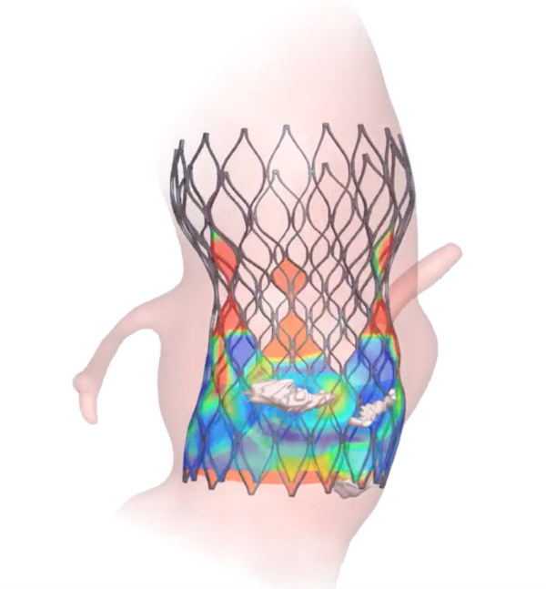 FEOPS | Dassault Systèmes®